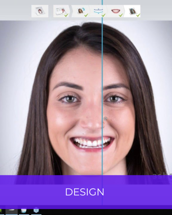Smile Design Studio - Melorin - Digital Dental Studio