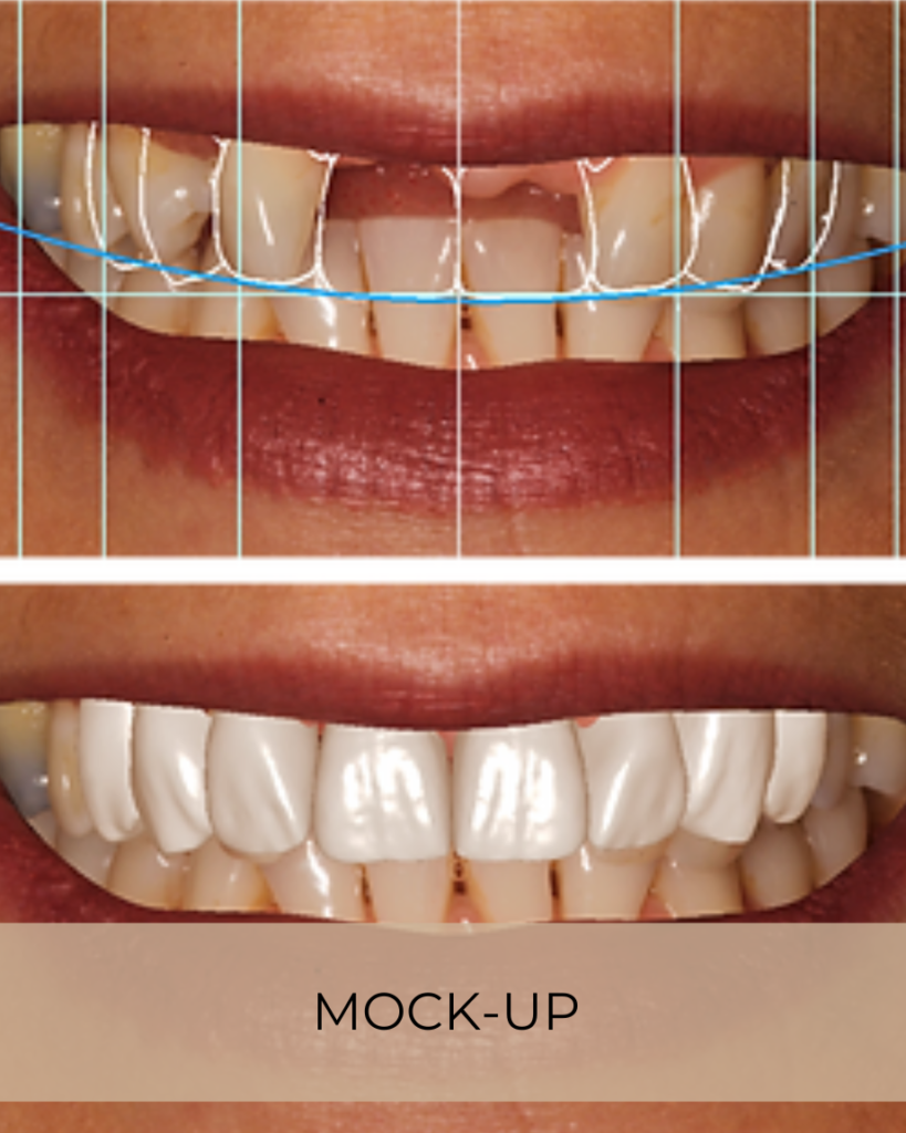Smile Design Studio - Melorin - Digital Dental Studio